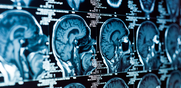 Your Complicated Amygdala: Why Brain-Imaging Work Is Misleading - The ... Your Complicated Amygdala: Why Brain-Imaging Work Is Misleading - The ...